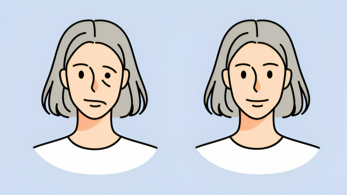 Acupuncture Treatments to Cure Facial Paralysis | Holac